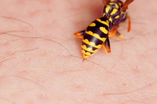 red wasp sting